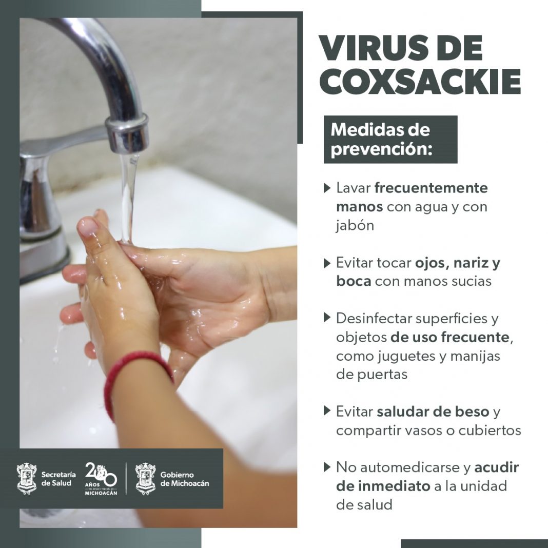 Conoce cómo prevenir el virus coxsackie que afecta a menores de 5 años – El Clarín