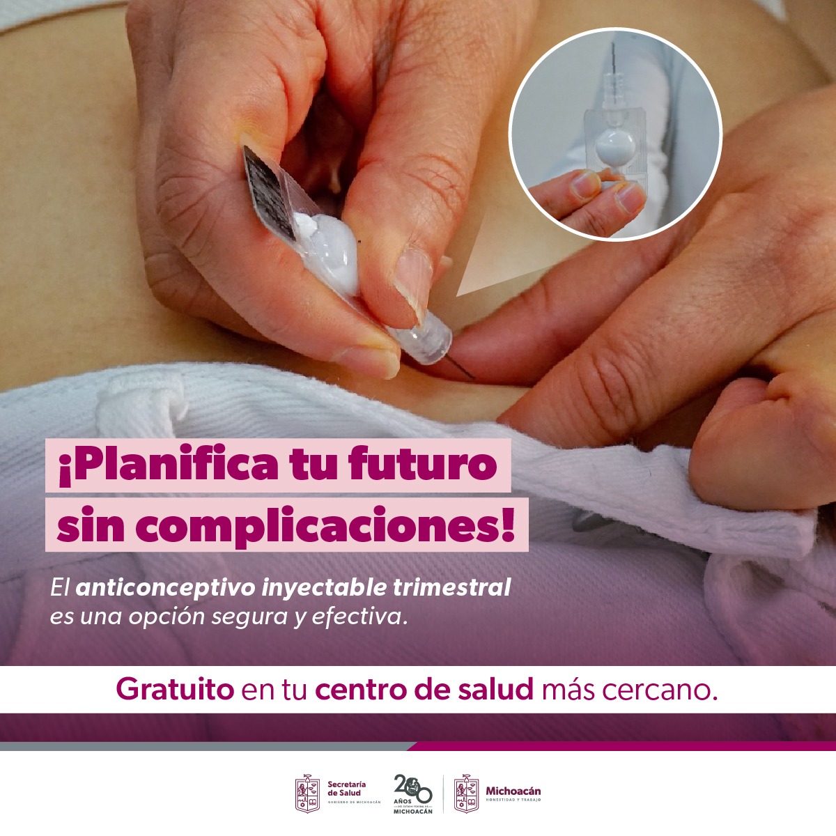 ¿Conoces el anticonceptivo inyectable? La SSM lo brinda sin costo – El ...
