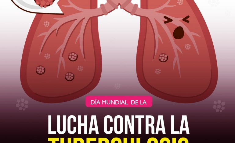 Prevención y detección, claves para combatir la tuberculosis: SSM – El ...