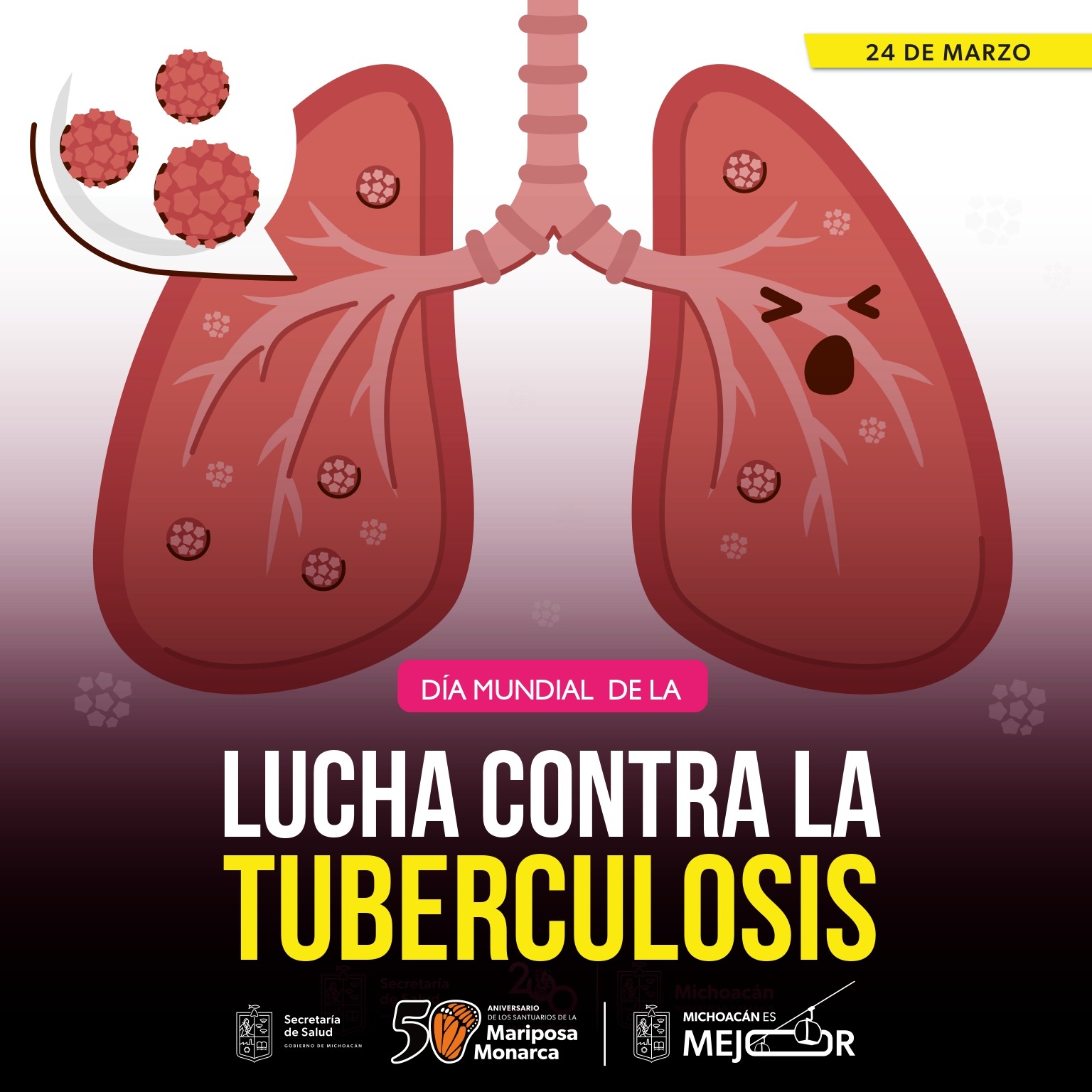 Prevención y detección, claves para combatir la tuberculosis: SSM – El ...